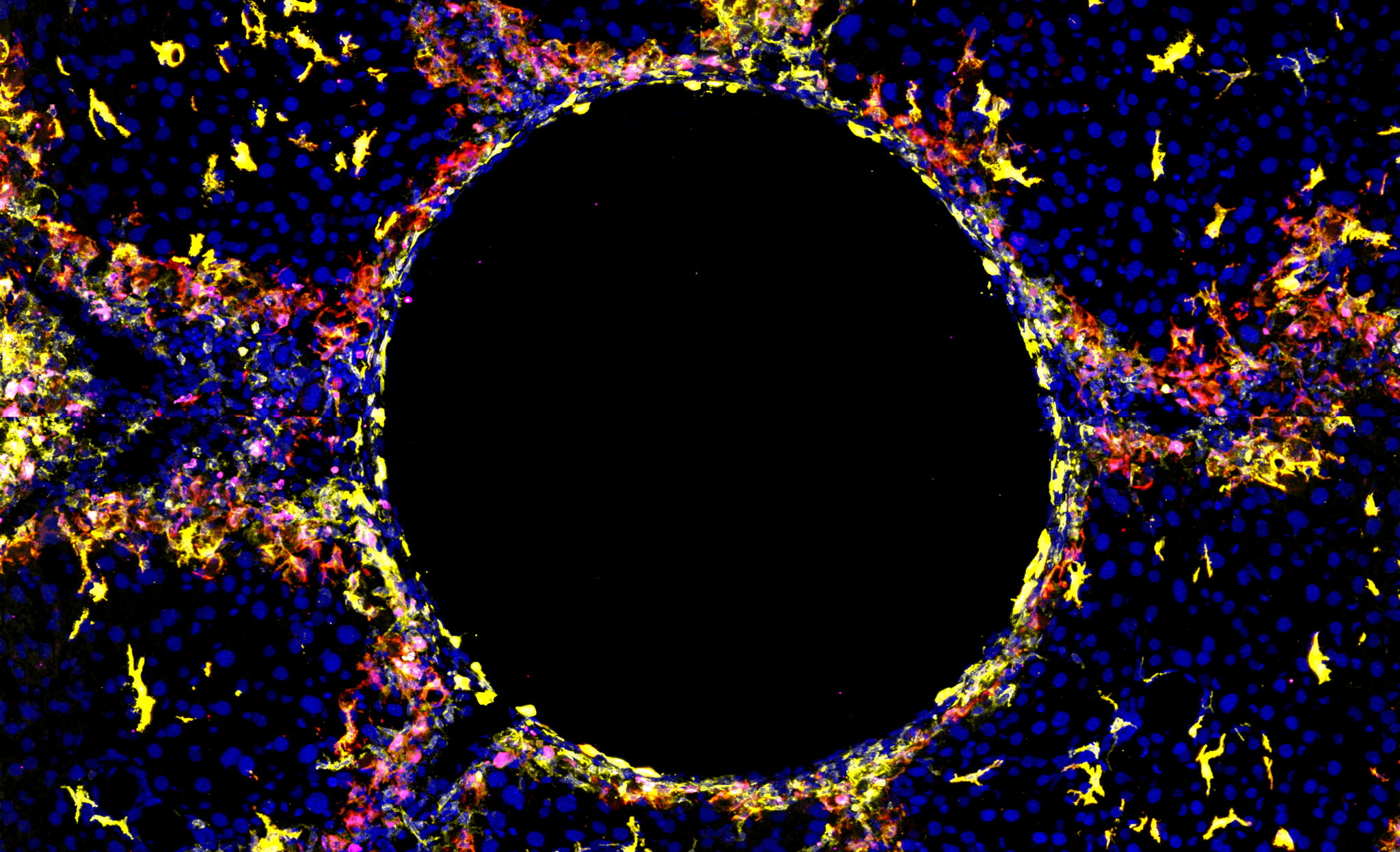 Specific types of liver immune cells are required to deal with injury