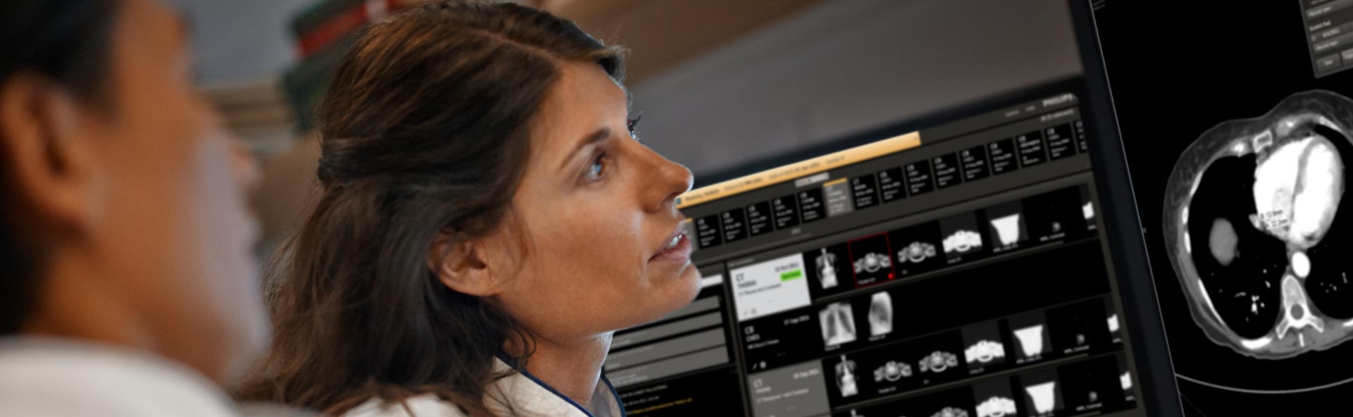 Philips au RSNA 2016