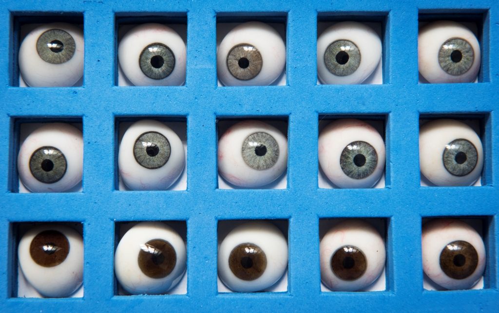 Eerste op maat gemaakte oogprothese op basis van 3D-print