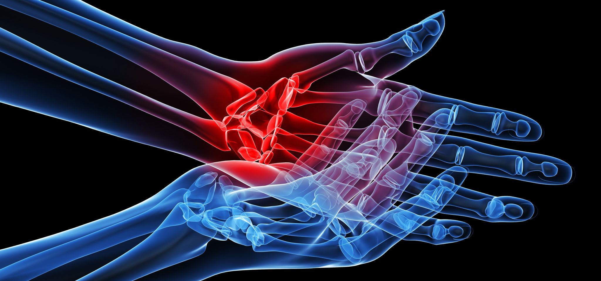Erosion blockade breakthrough: clinical trial signals hope for hand ...