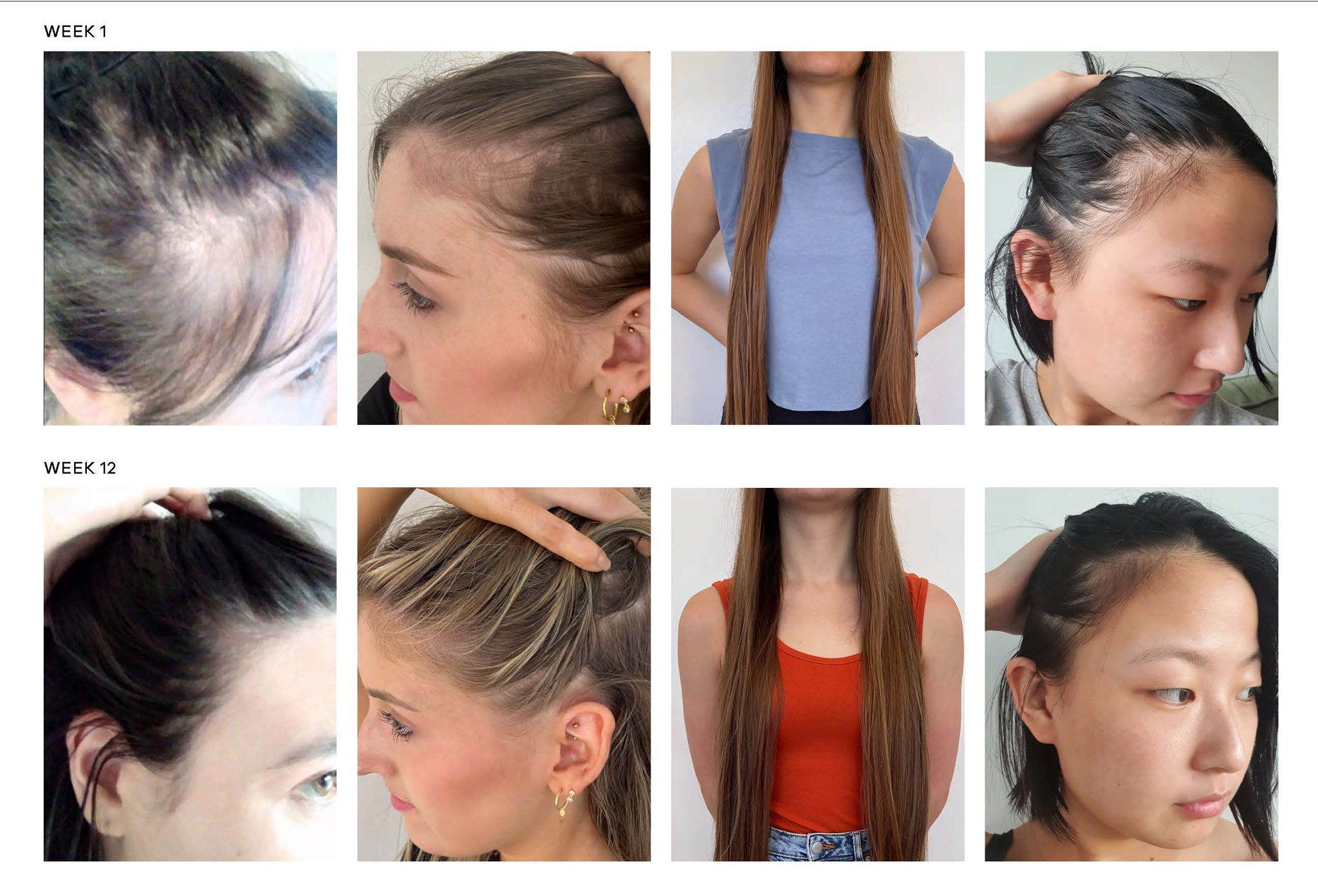 How To Promote Healthy Hair Growth & Overcome Hair Loss | Frost Magazine