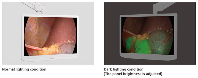 Introducing LMD-32M1MD: Sony's advanced 4K mini-LED medical monitor for ...