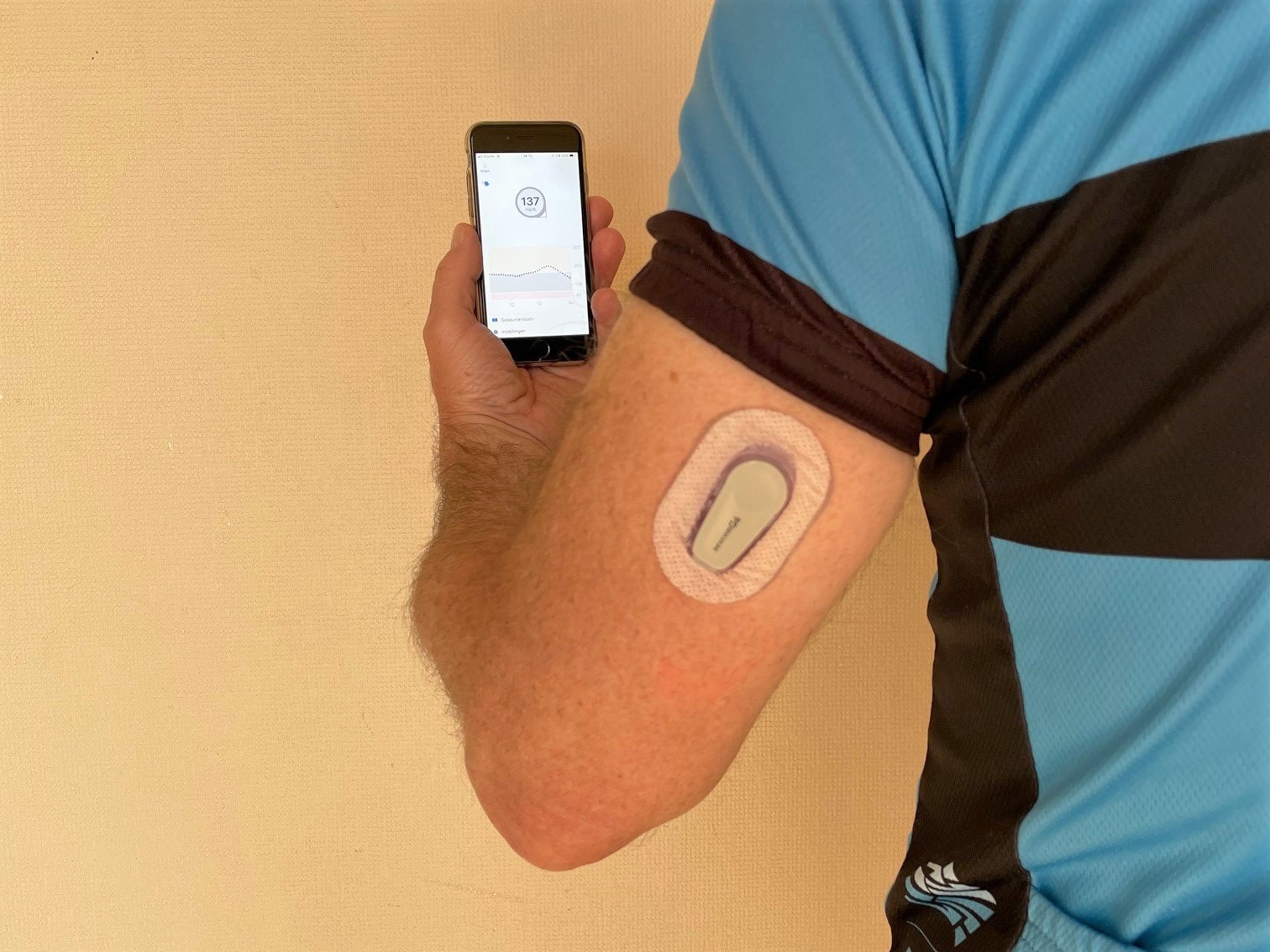 Glucosesensor met alarm heeft grote meerwaarde bij diabetes type 1